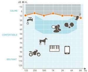 La mesure - Centre auditif audioprothésiste et bilan auditif - Audilab